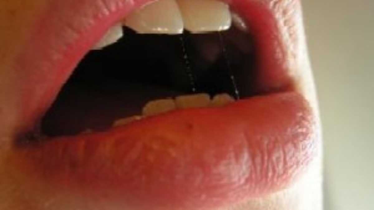 Quand analyser l'haleine permet de diagnostiquer une maladie