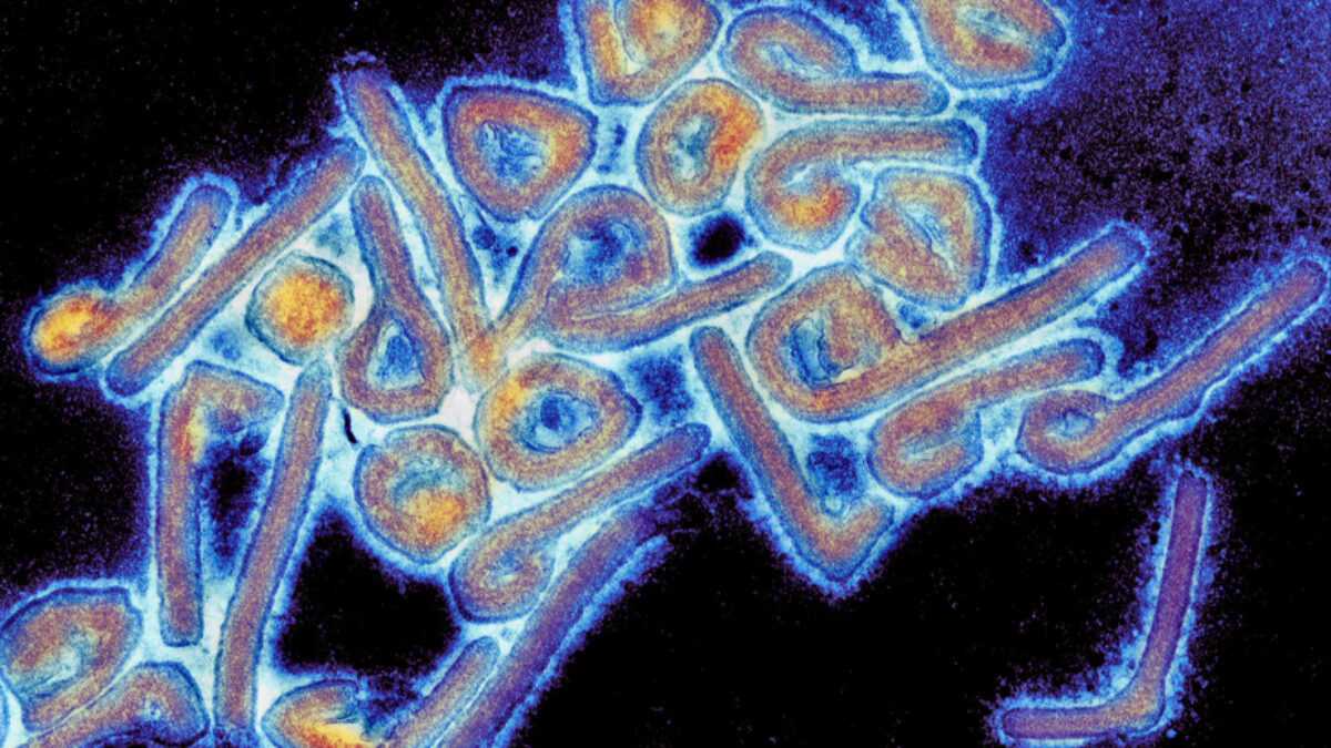 Deux cas de virus Marburg détectés au Ghana